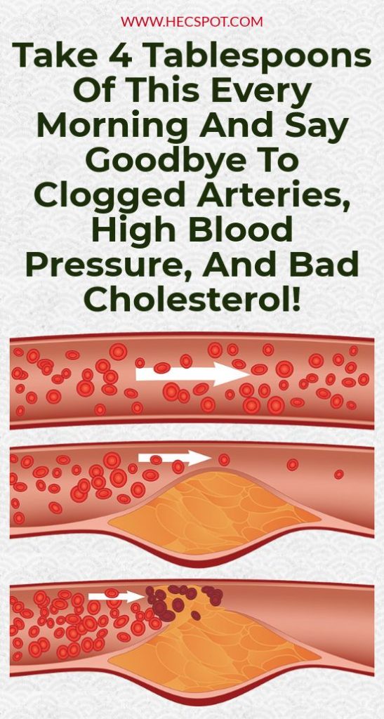 Take 4 Tablespoons Of This Every Morning And Say Goodbye To Clogged