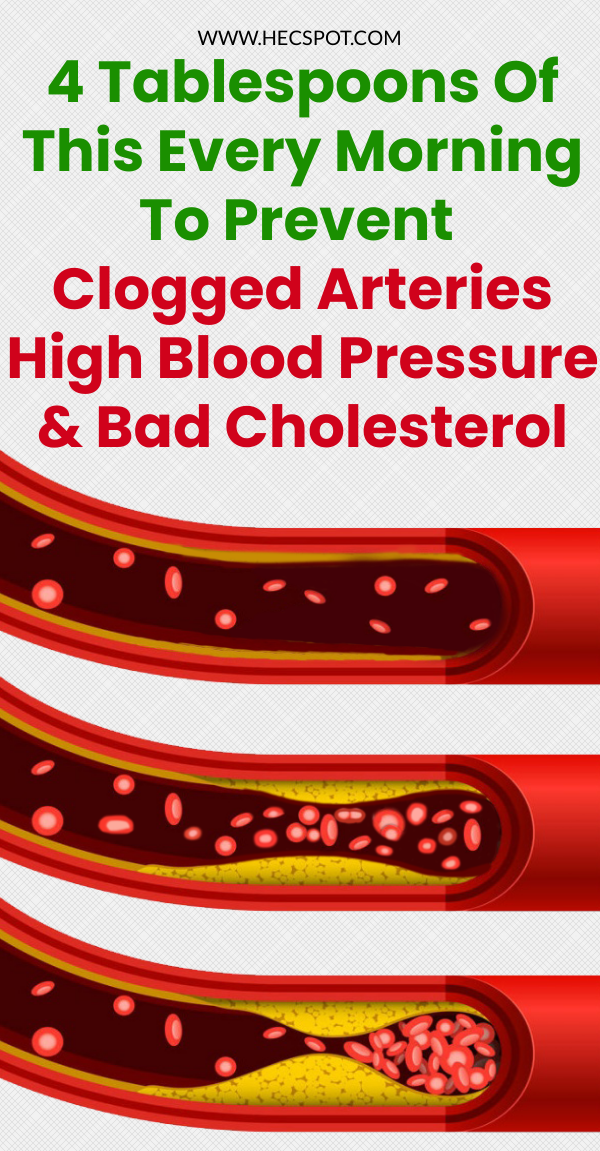 Take 4 Tablespoons Of This Every Morning And Say Goodbye To Clogged